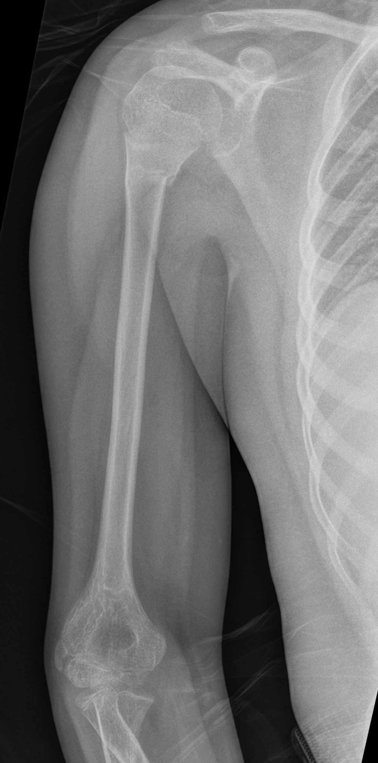 Paediatric trauma imaging – THE PTN